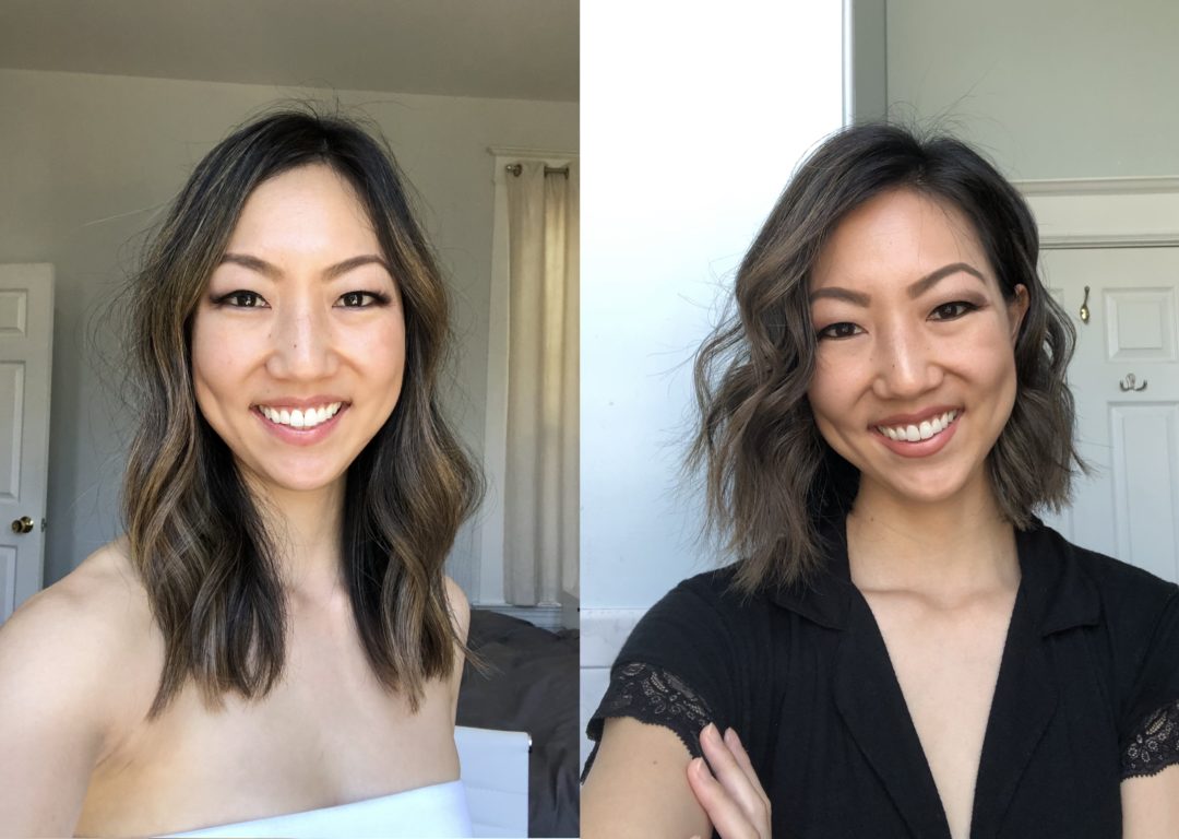 My Experience Getting Kybella – TREND ENVY