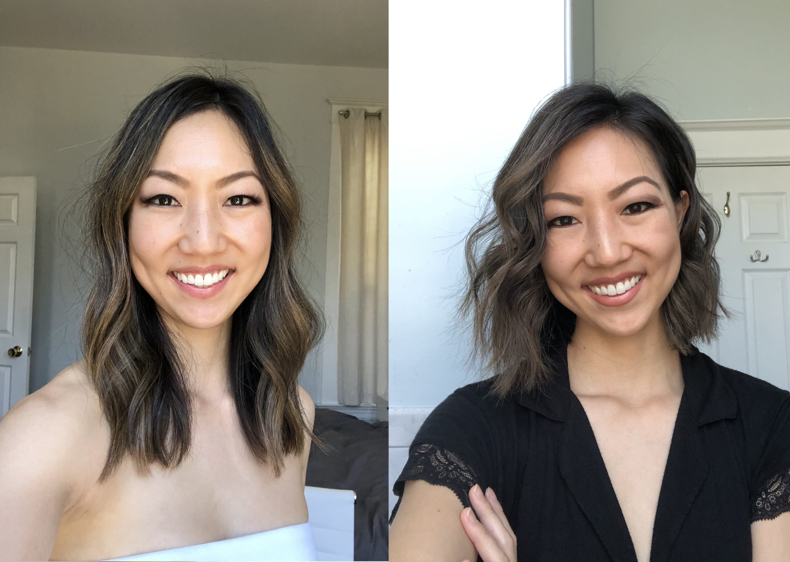 My Experience Getting Kybella – TREND ENVY